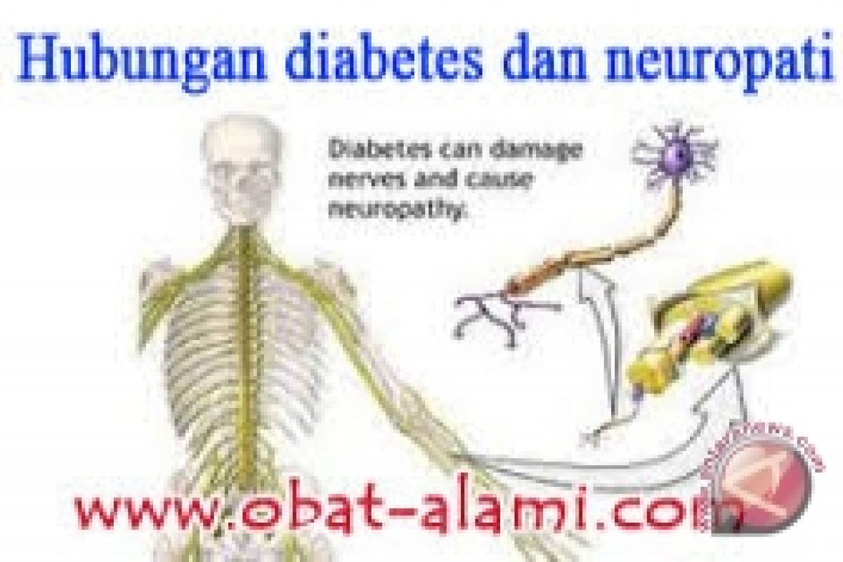 Perdossi: neuropati sering tidak disadari sebagai penyakit - ANTARA ...